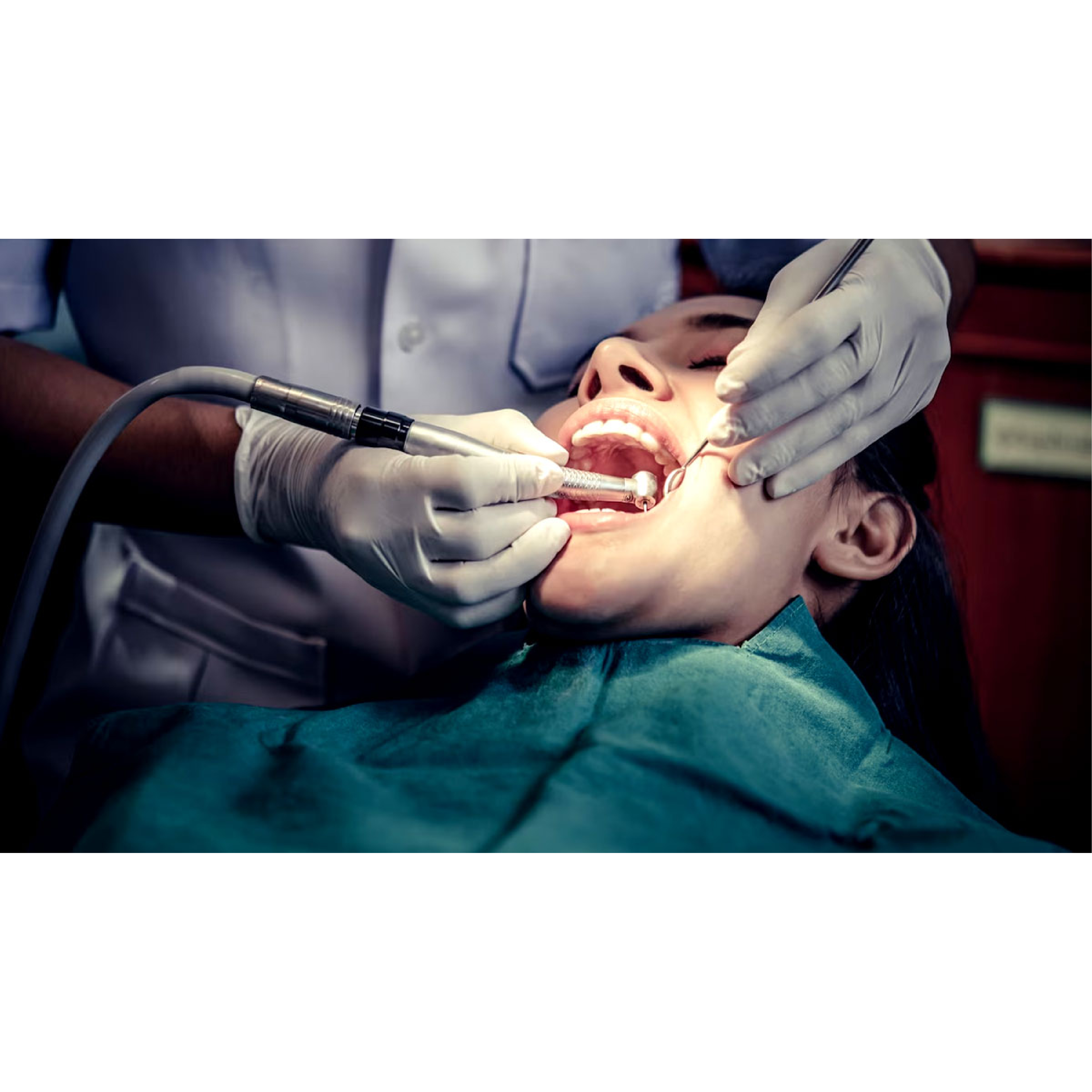 Root Canal Treatment – Ritz Dental Care