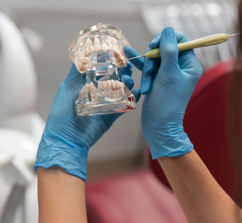 Digital Smile Makeover – Ritz Dental Care